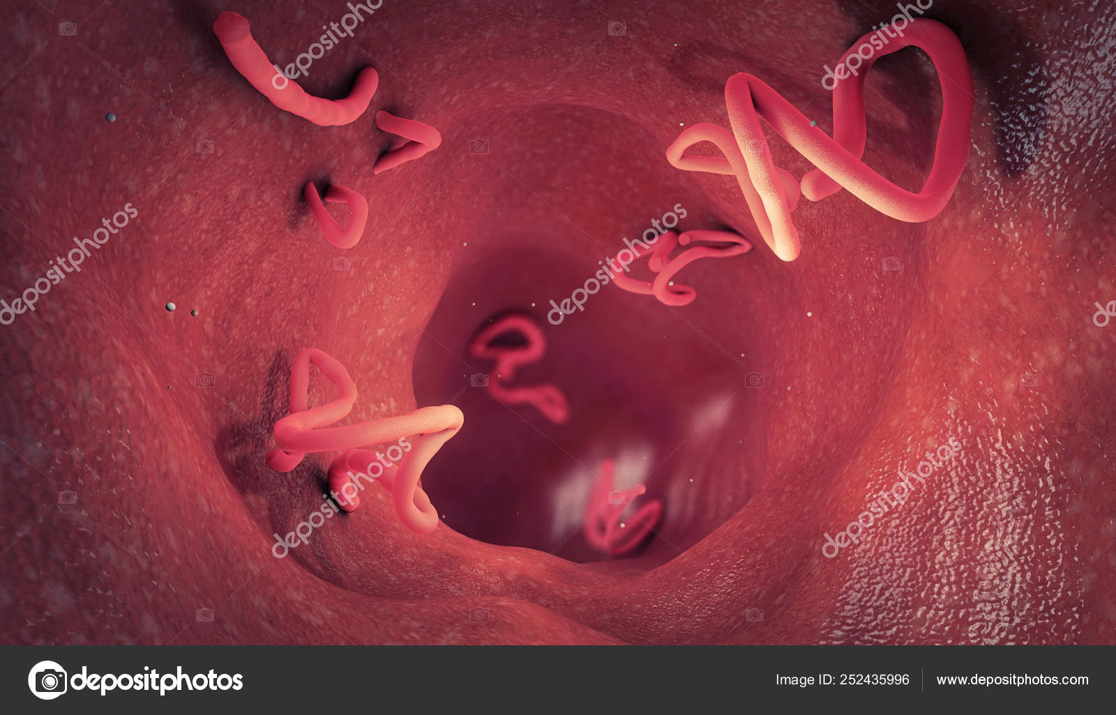 Tapeworm infestation in a human intestine - 3d illustration — Stock ...