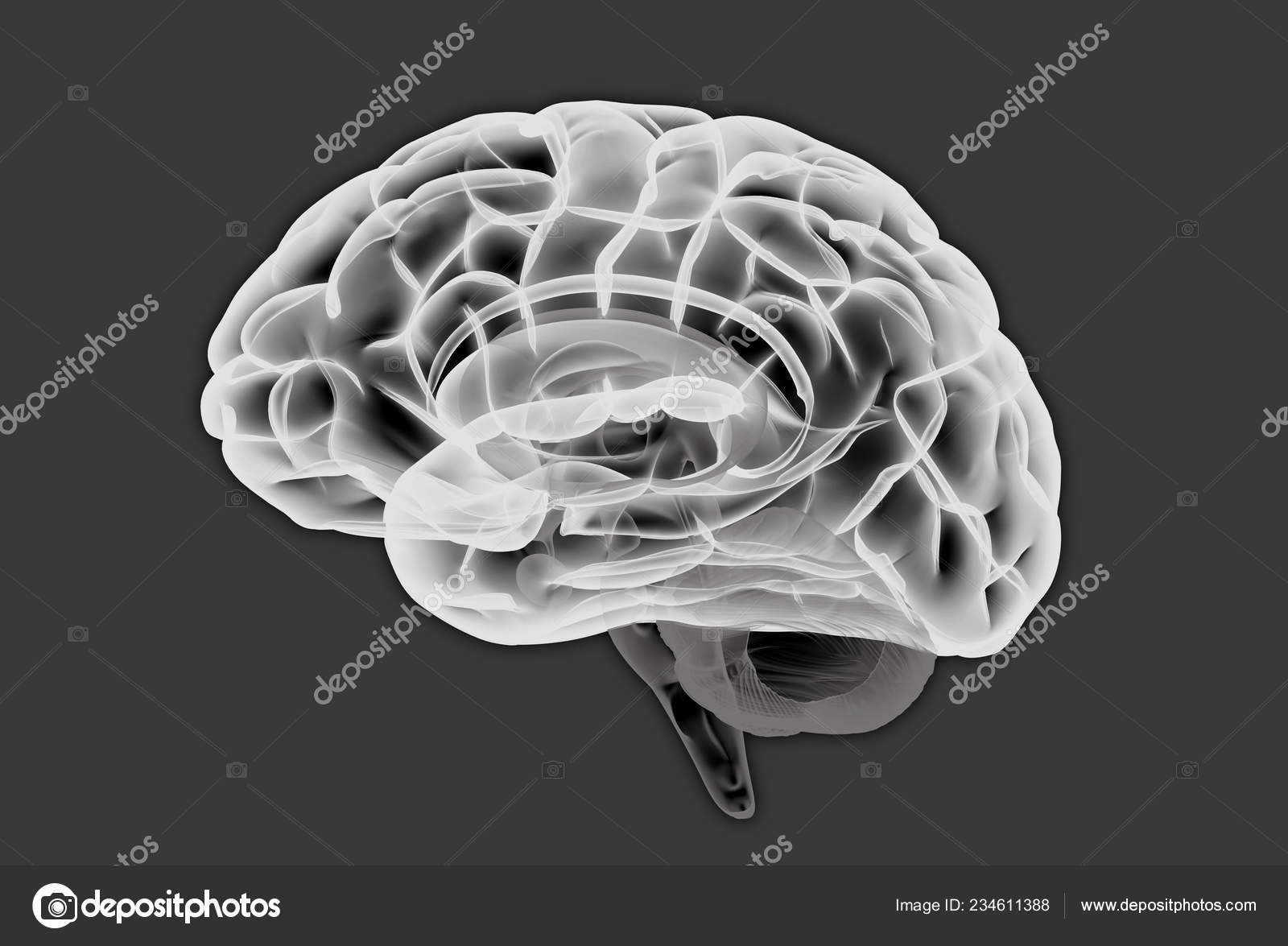 Xray Brain Illustration Isolated Dark Background Clipping Path Die Cut ...