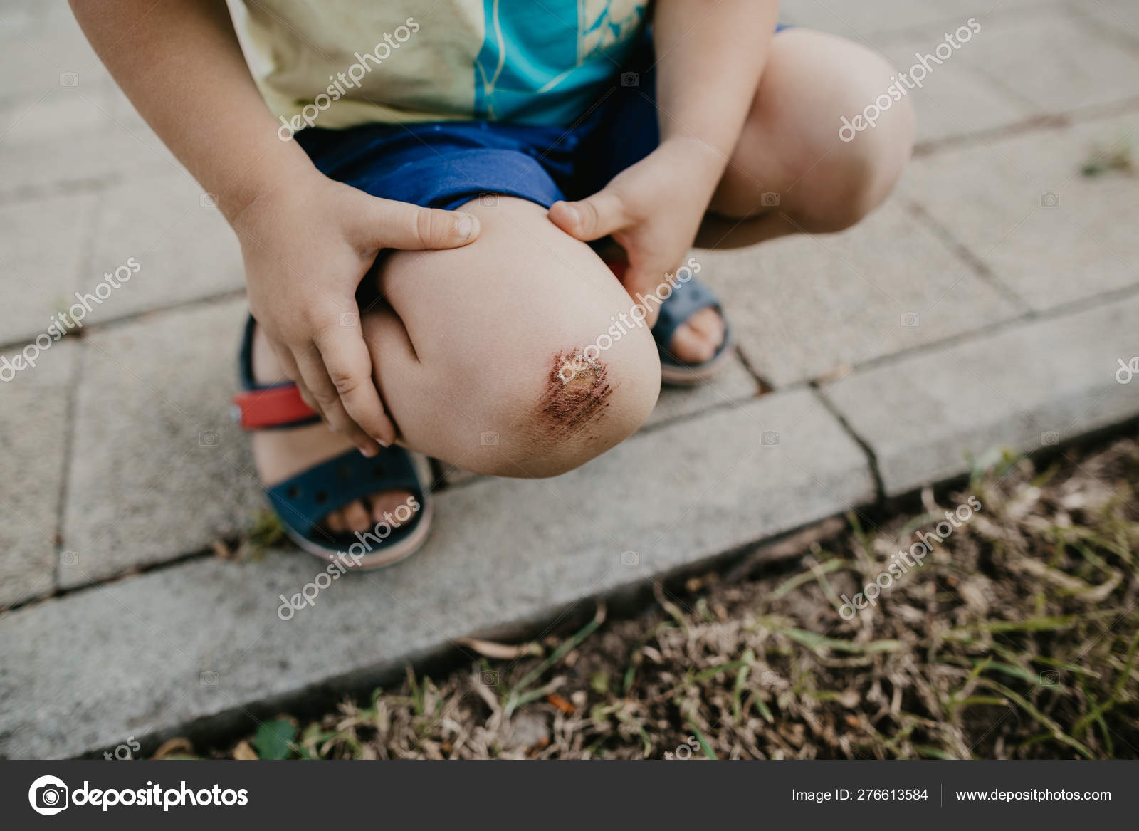 Child Hurt Knee