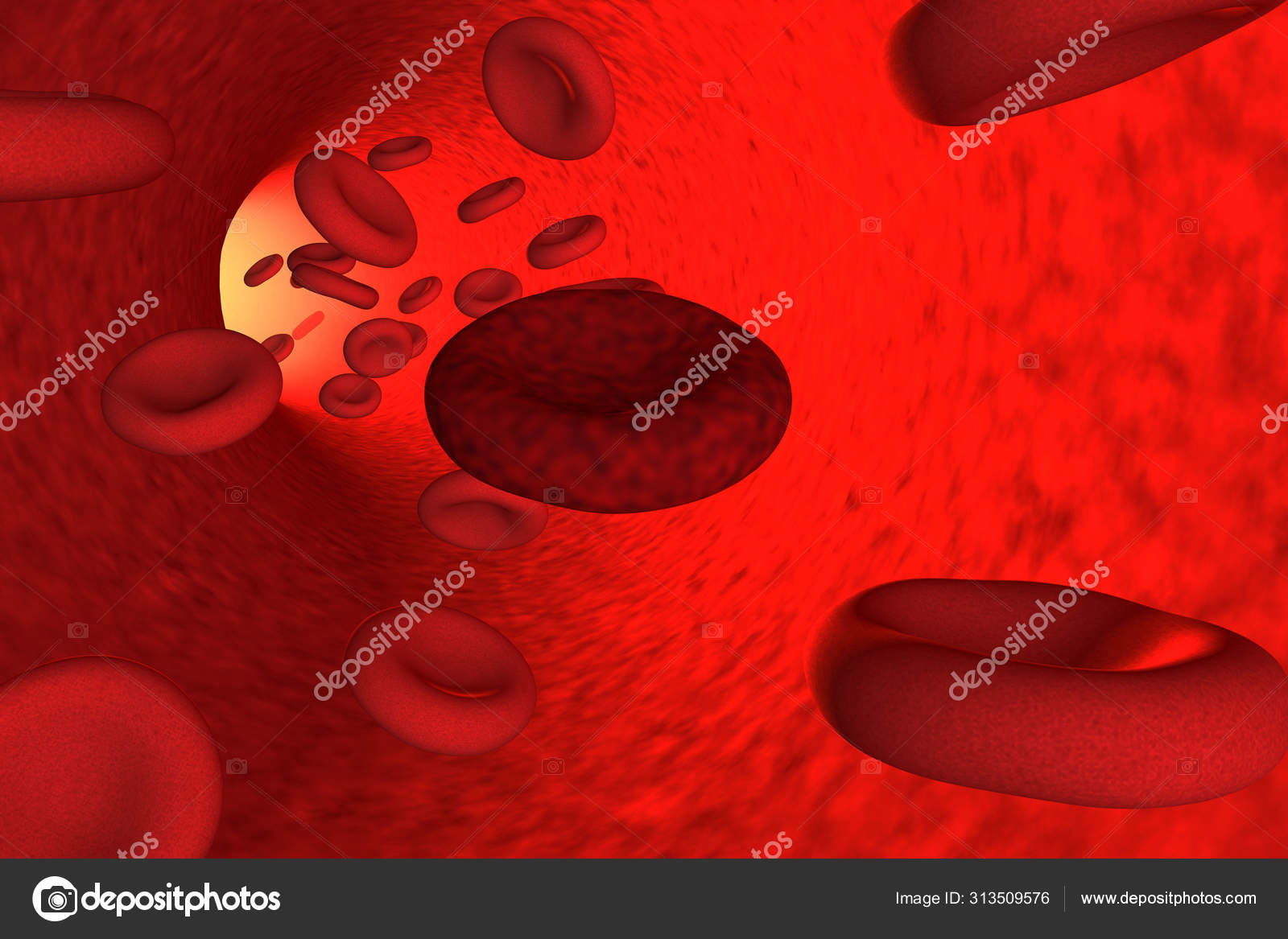 Sick red blood cell with dark spots inside the artery Stock Photo by ...
