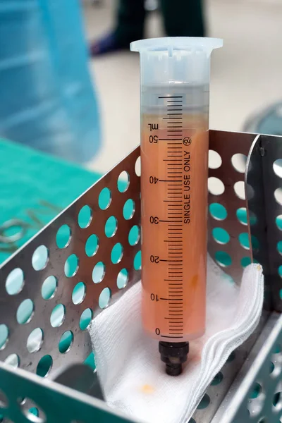 Fat injection Stock Photos, Royalty Free Fat injection Images ...