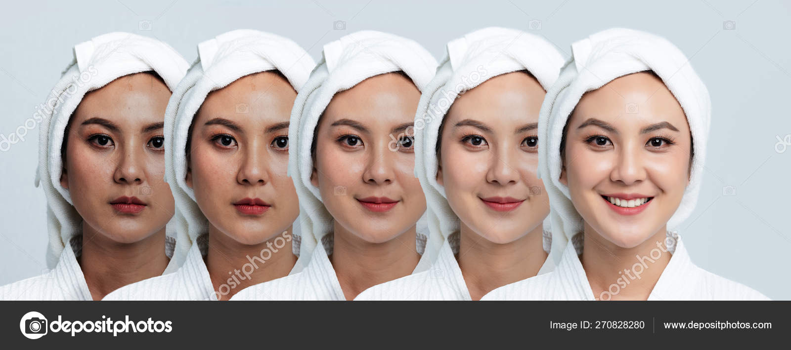 Comparison Portrait Beautiful Asian Woman Dark Spots New Skin Skin ...