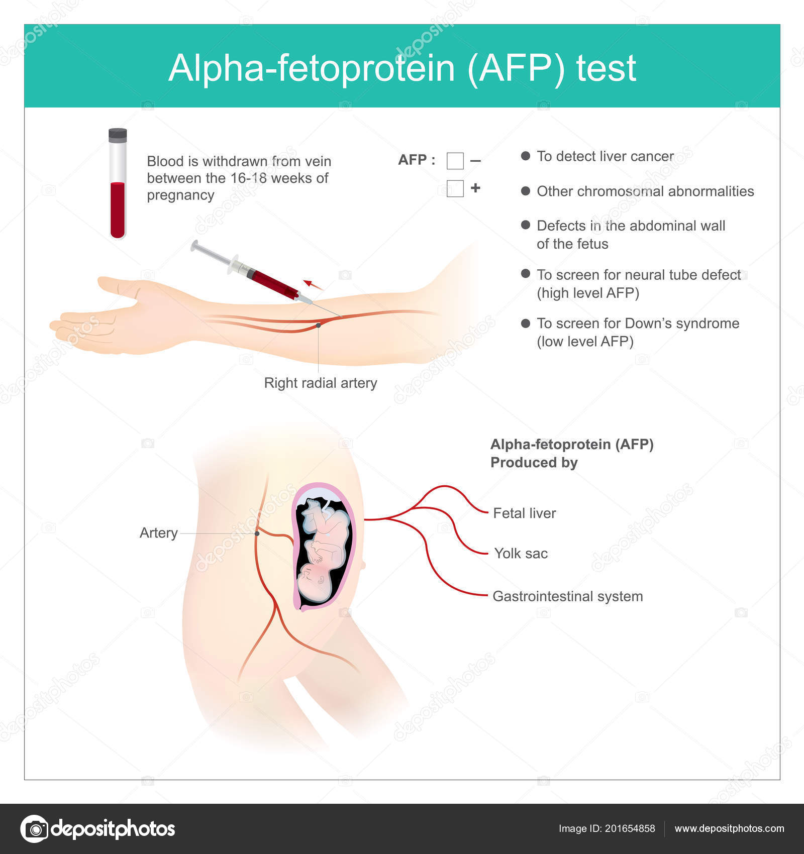 Alpha Fetoprotein Afp Test Use Analysis Afp Level Detect Liver Stock ...