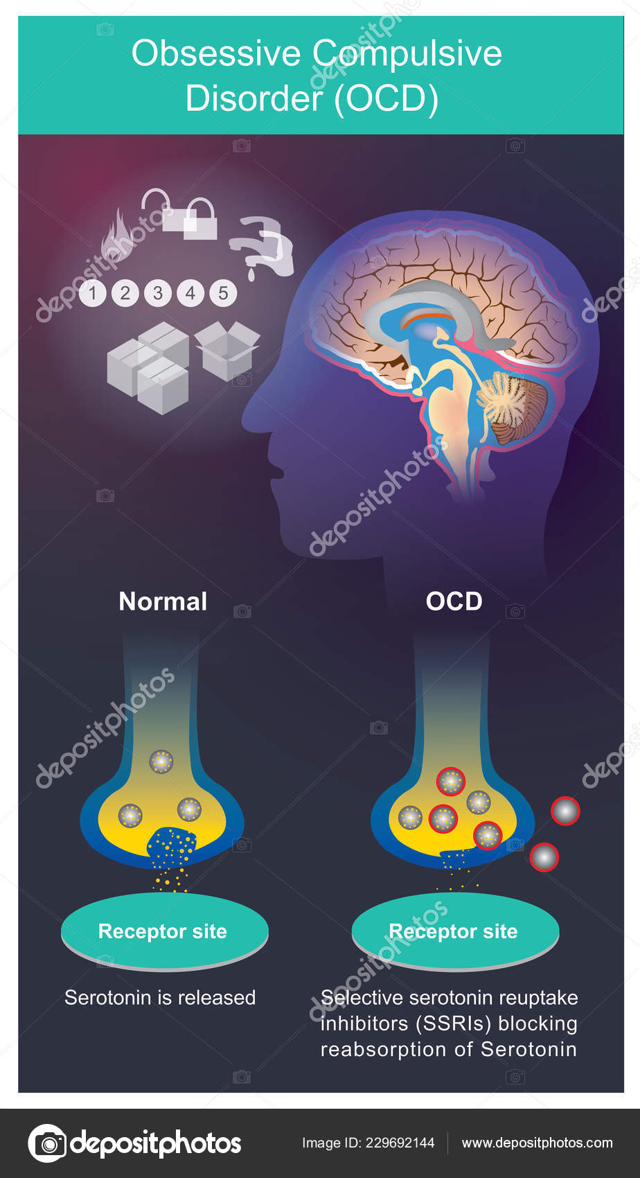 Ocd Brain Serotonin