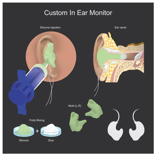 In ear monitors Vector Art Stock Images | Depositphotos