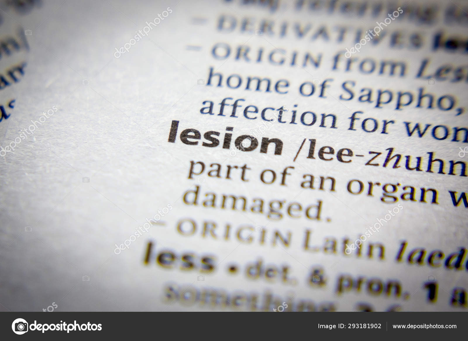 Word or phrase Lesion in a dictionary. — Stock Photo © sharafmaksumov ...