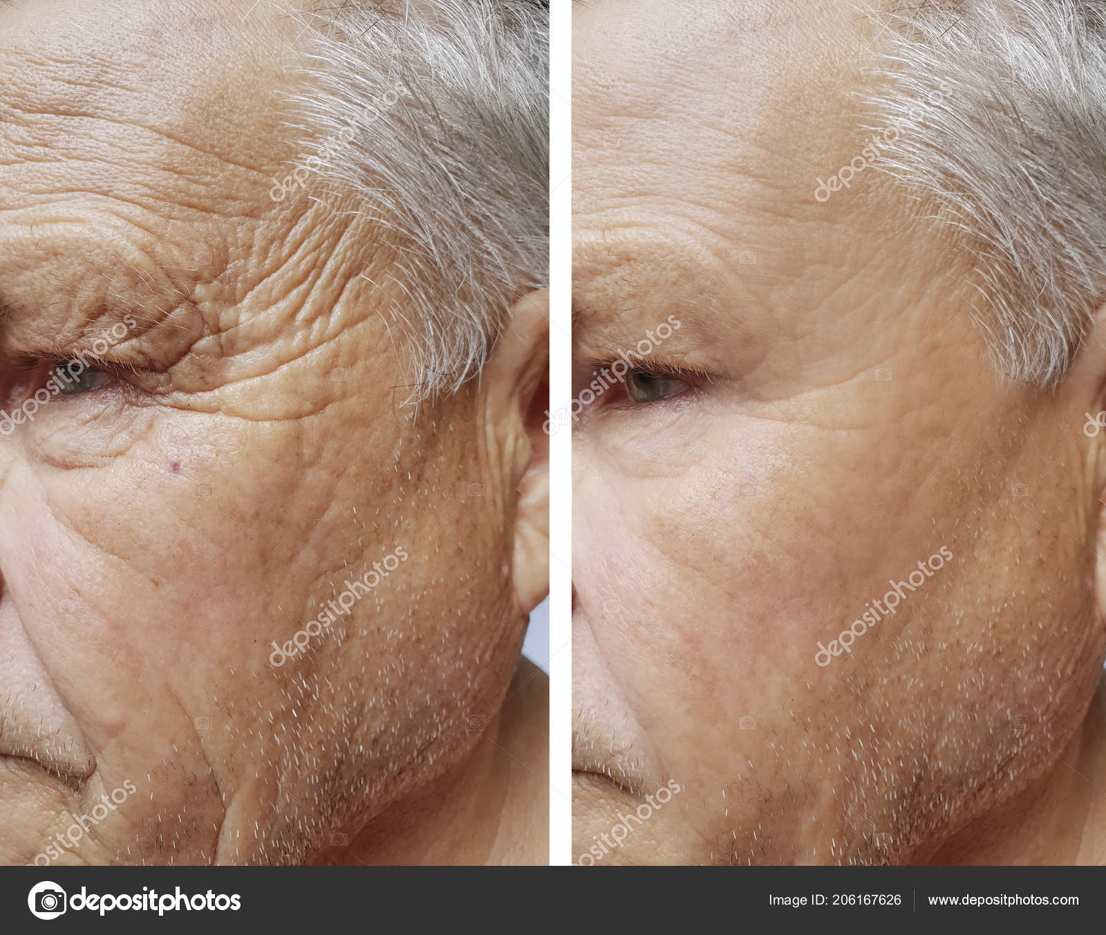 Old Man Wrinkle Face