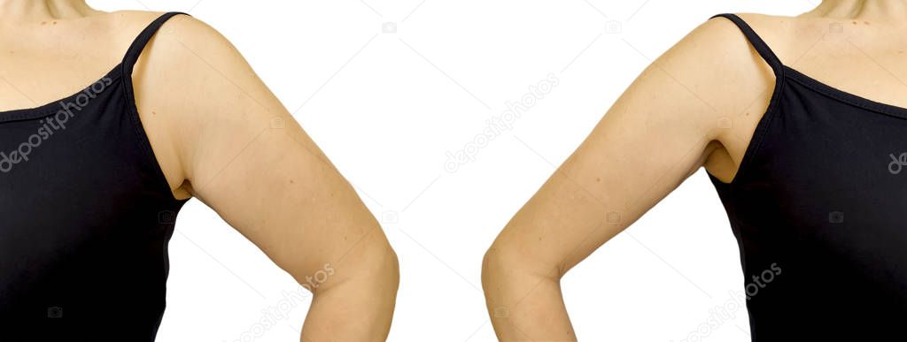 Procedure of exercise Stock Photos, Royalty Free Procedure of exercise ...