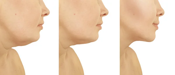 Fotos de Anatomia humana face, Imagens de Anatomia humana face sem ...