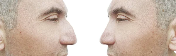 Man long nose Stock Photos, Royalty Free Man long nose Images ...