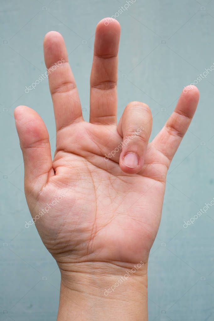 Gatillo Cerradura del dedo en el dedo anular de la mano izquierda ...