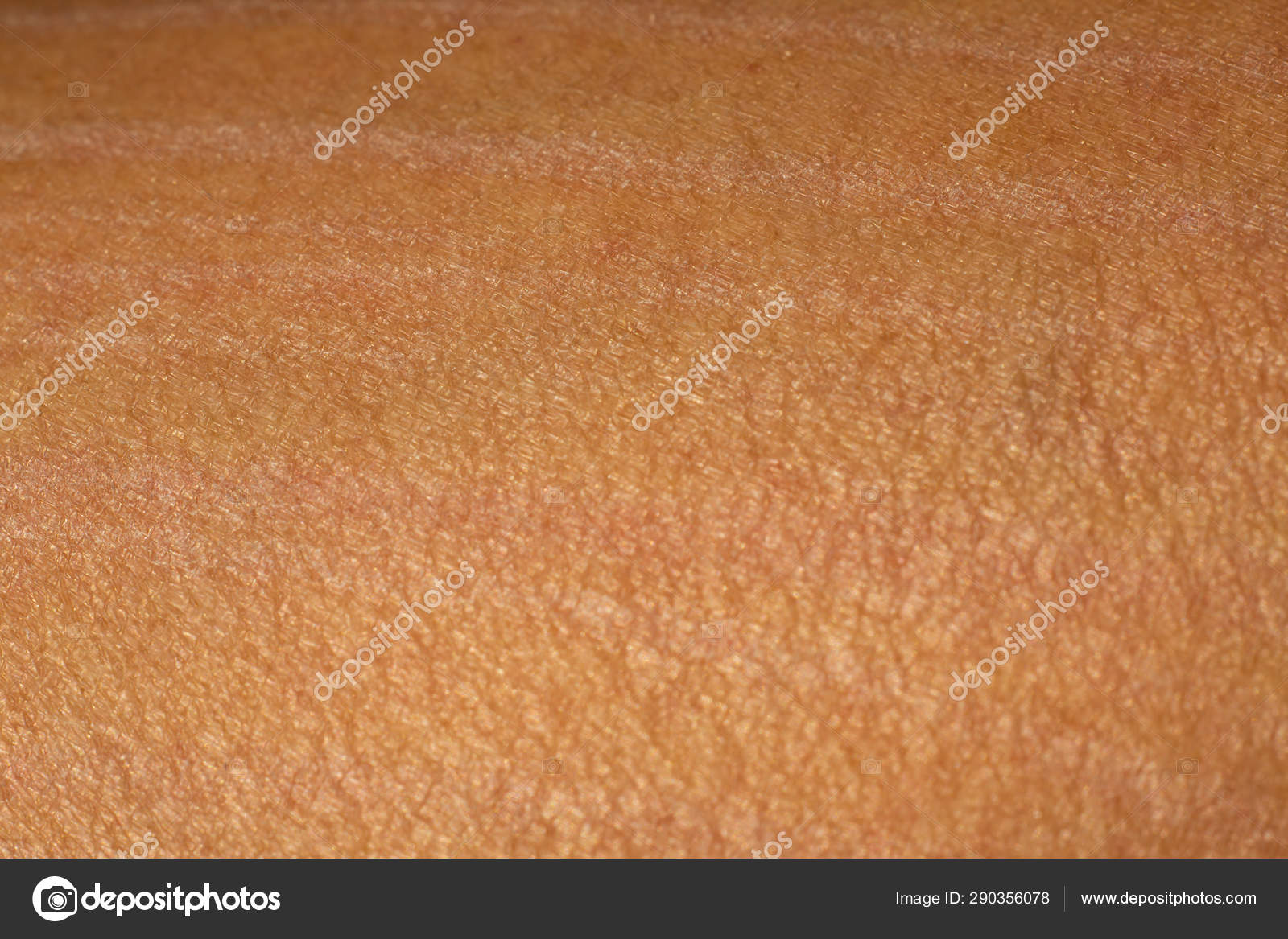 Woman's scratch and dry skin on leg, Close up & Macro shot, Asian Body ...