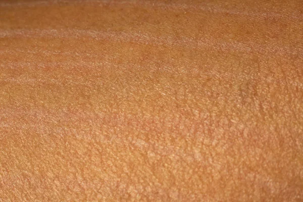 Dry skin scratch Stock Photos, Royalty Free Dry skin scratch Images ...