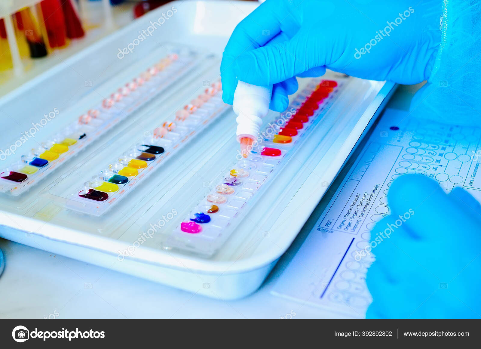 Microbiological Laboratory Mold Fungal Cultures Bacterial Research ...